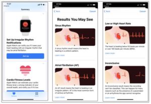8 Smartwatch Sensors - How they work