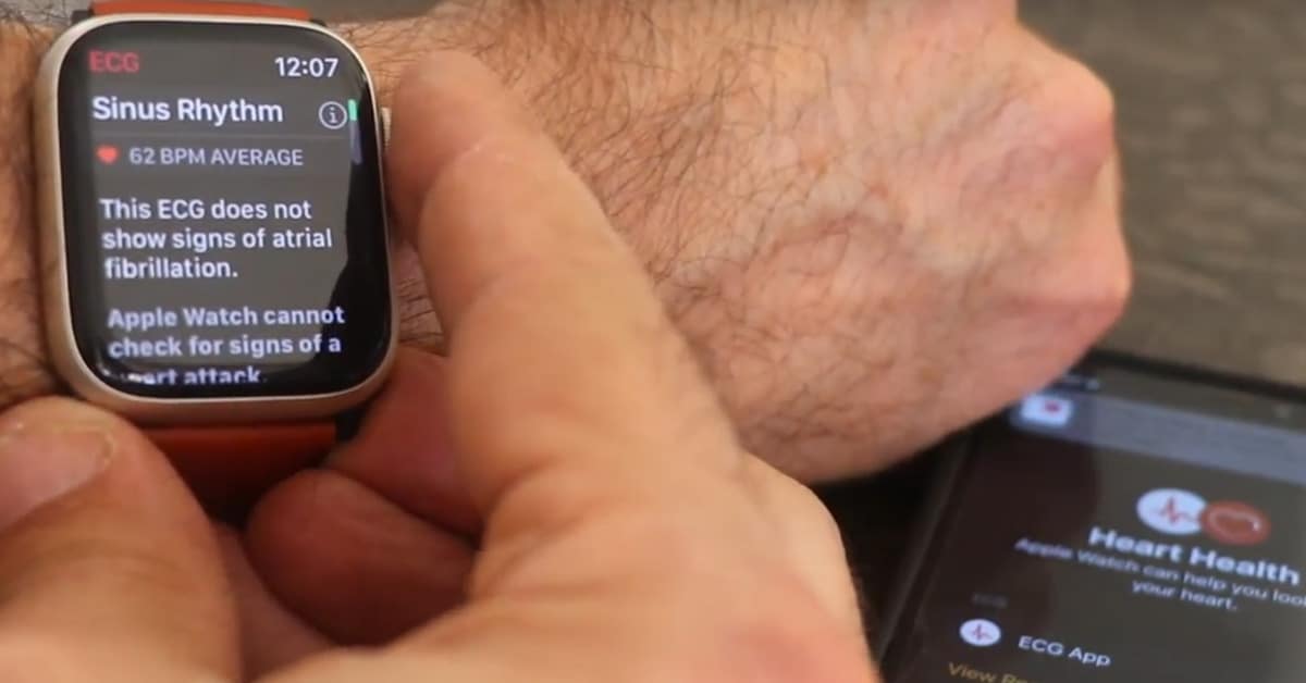 Choosing the Best Apple Watches for Men